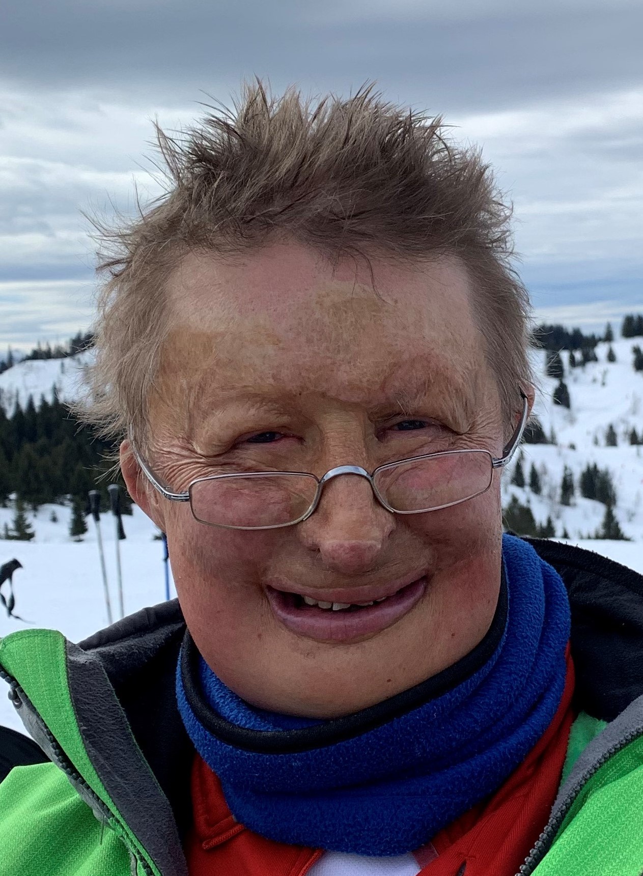 JAMES PARTRIDGE OBE, DSc (Hon), FRCSEd (Hon) – AXSChat